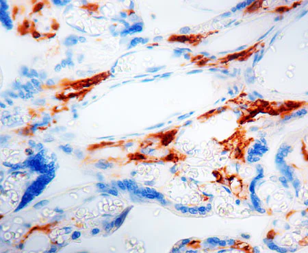 Anti-Factor XIIIa antibody (ab4057) | Abcam
