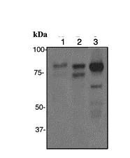 Anti-Factor XIIIa antibody [EP3371] - BSA and Azide free (ab284764) | Abcam