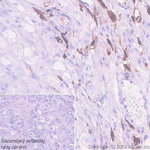 Anti-Factor XIIIa antibody [EP3372] (ab76105) | Abcam
