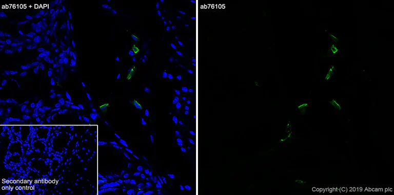 Anti-Factor XIIIa antibody [EP3372] (ab76105) | Abcam