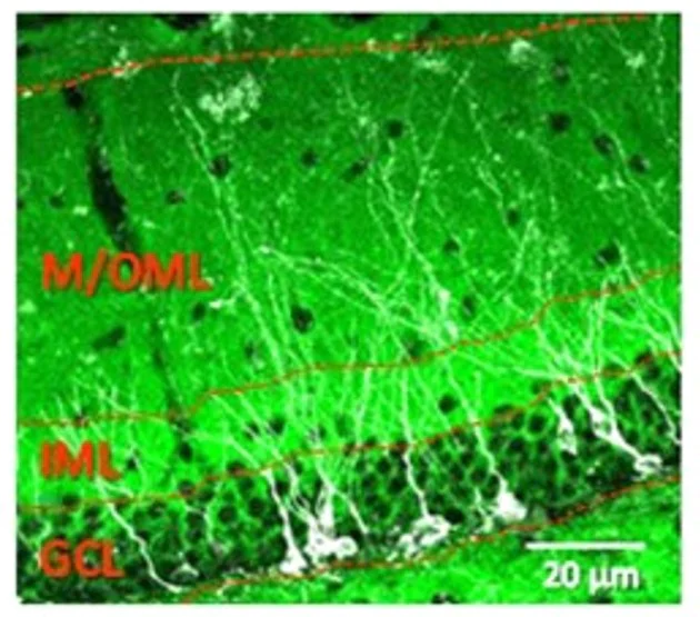 Anti-fade fluorescence mounting medium - aqueous, fluoroshield (ab104135) | Abcam