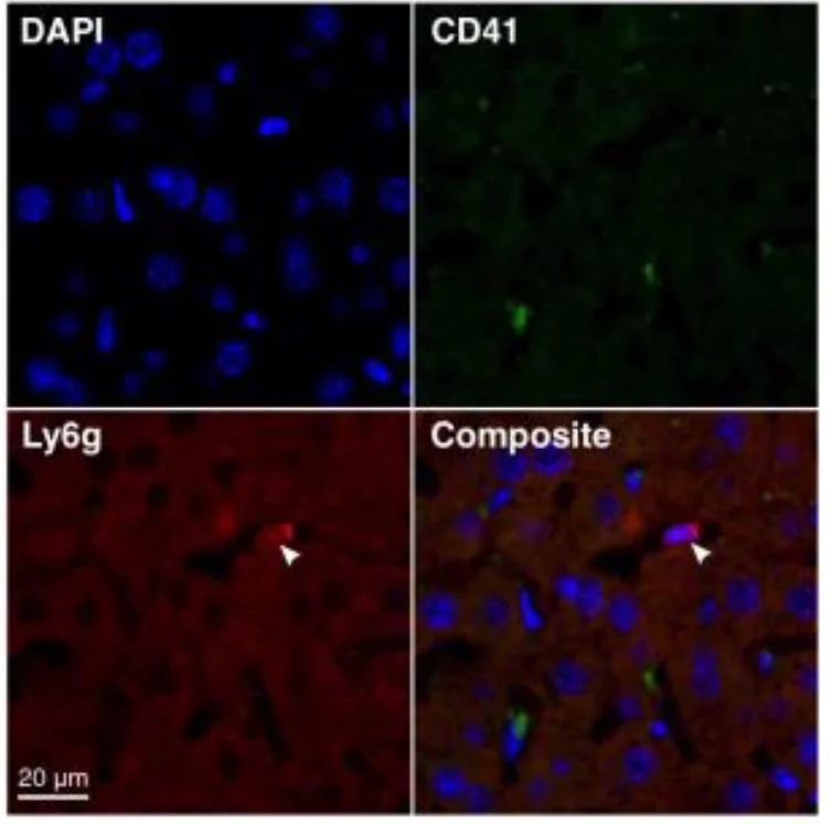Anti-fade fluorescence mounting medium - aqueous, fluoroshield ...