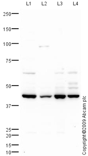 Anti-FADS2 antibody KO Tested (ab72189) | Abcam