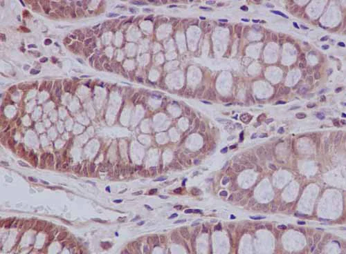 Anti-FAF1 antibody [EPR14754] (ab183045) | Abcam