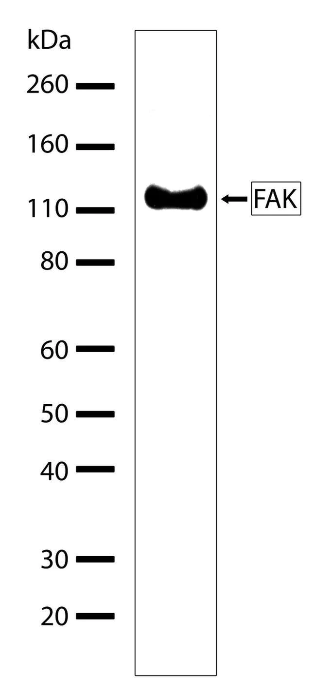 Anti-FAK antibody [RP23040020] (ab307996) | Abcam