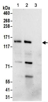 FAM120A/OSSA抗体 (ab106454)| Abcam中文官网