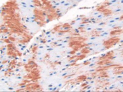 Anti-FAM19A2 antibody (ab231186) | Abcam