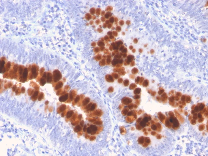 Anti-Fas antibody [FAS/3112] (ab269675) | Abcam