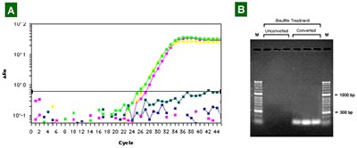 Fast Bisulfite Conversion Kit (ab117127) | Abcam