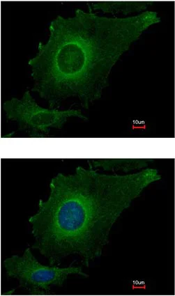 Anti-FBXO4/FBX4 antibody (ab153803) | Abcam