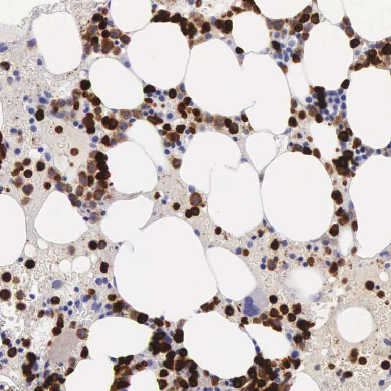 Anti-FCN1/M-Ficolin antibody (ab223712) | Abcam