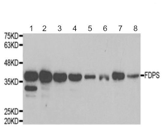 Anti-FDPS/FPS antibody - C-terminal (ab189874) | Abcam