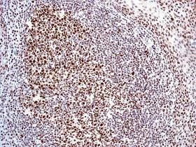 Anti-FEN1 antibody [EPR4460(2)] - BSA and Azide free (ab239948) | Abcam