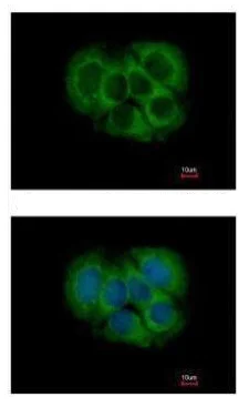 Anti-FGFR1OP2 antibody (ab229119) | Abcam