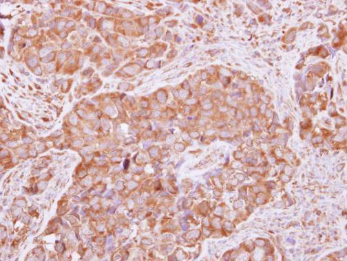 Anti-FGFR1OP2 antibody (ab229119) | Abcam