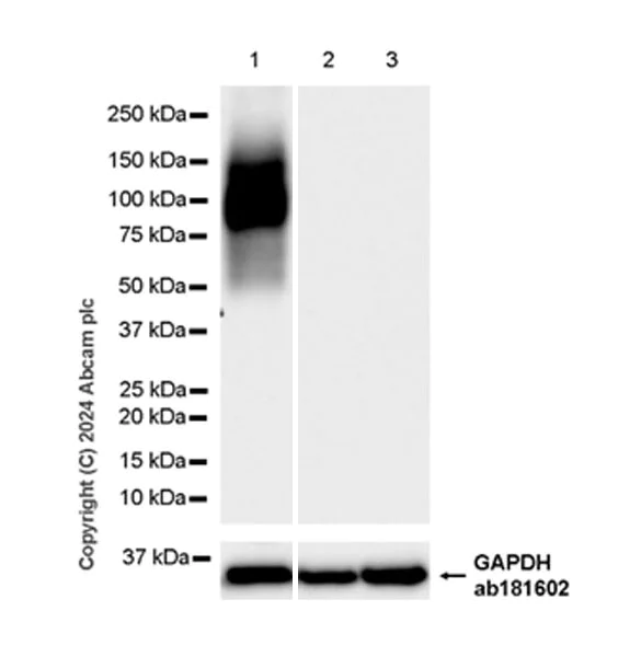 FGFR2IIIb/FGFR2b抗体[EPR28355-27] - BSA and Azide free (ab318275)| Abcam中文官网