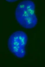 Fibrillarin抗体- Nucleolar Marker (ab5821)| Abcam中文官网