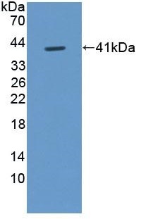 Anti-FIGN/Fidgetin antibody (ab232756) | Abcam