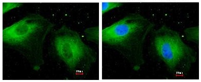 Anti-Filamin B antibody (ab97457) | Abcam