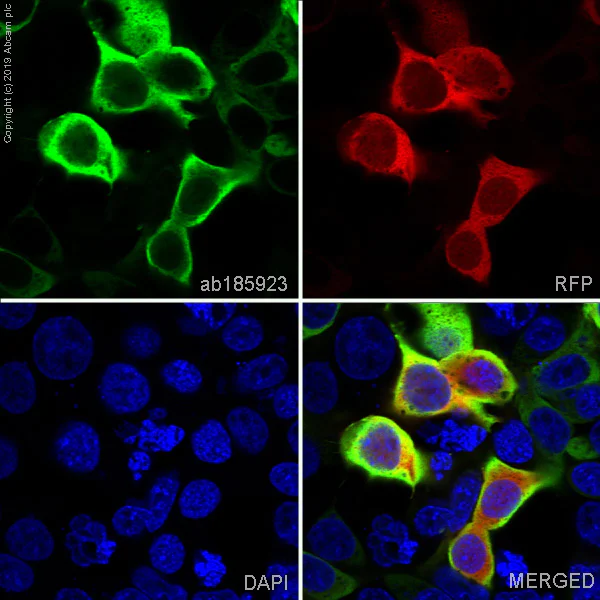 Anti-Firefly Luciferase antibody [EPR17789] - N-terminal (ab185923) | Abcam