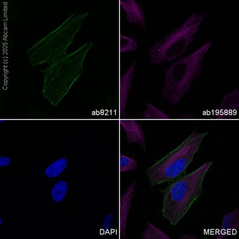 Smooth Muscle Ab Screen
