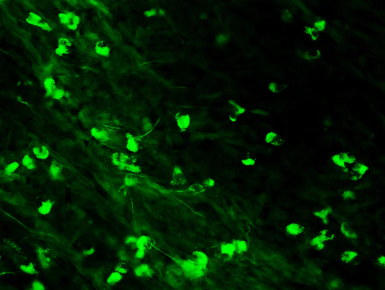 Anti-Human IgA FITC antibody (ab4219) Rabbit polyclonal IgG | Abcam