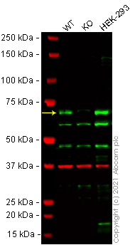 Anti-FLCN antibody (ab87753) | Abcam