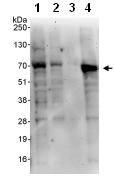 Anti-FLCN antibody (ab87753) | Abcam