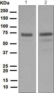 Anti-FLCN antibody [EPNCIR147] (ab124885) | Abcam