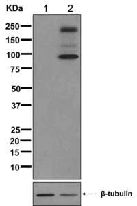 Flt3 / CD135(磷酸化Y591)抗体[EPR2159(2)] (ab171953)| Abcam中文官网