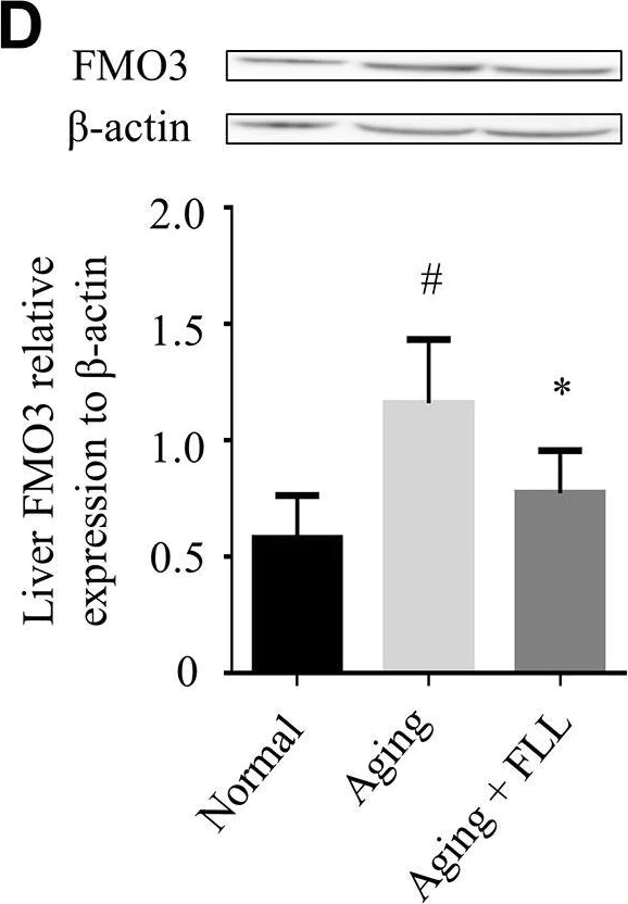 Anti-FMO3 antibody [EPR6968] (ab126711) | Abcam