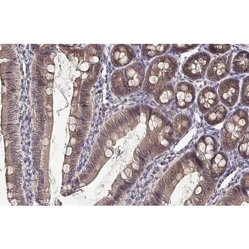 Anti-FN3K antibody [HL2223] (ab317168) | Abcam