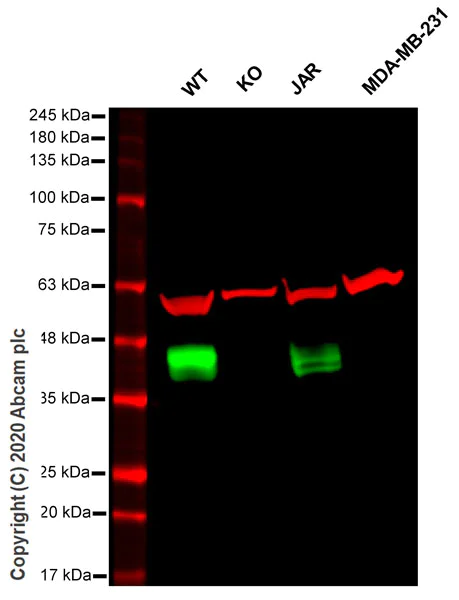 Folate Binding Protein/FBP抗体[EPR20277] (ab221543)| Abcam中文官网