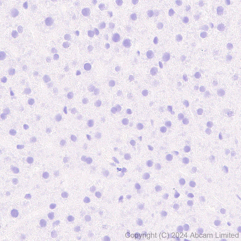 Anti-Folate Binding Protein/FBP antibody [RM1246] (ab322459) | Abcam