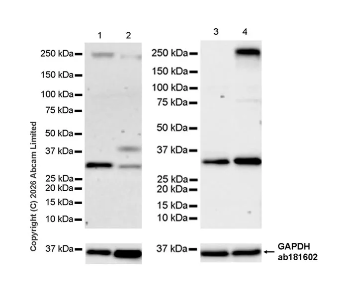 Anti-FOLR2 antibody [EPR30335-548] (ab325399) | Abcam中文官网