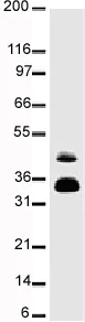 Anti-Fos B antibody [83B1138] (ab11959) | Abcam