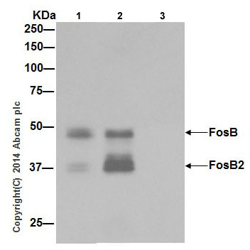 Anti-Fos B antibody [EPR15905] (ab184938) | Abcam