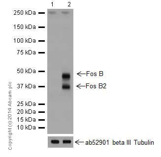Anti-Fos B antibody [EPR15905] (ab184938) | Abcam