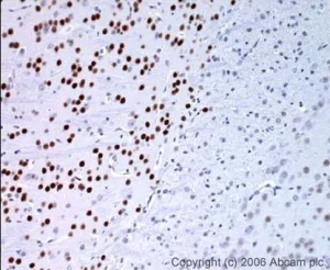 Anti-FOXP1 antibody (ab16645) | Abcam