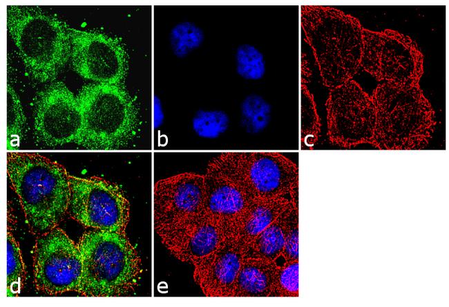 Anti-Frizzled 4 antibody [22HCLC] (ab277797) | Abcam