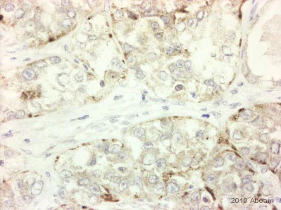 Anti-Frizzled 7 antibody (ab64636) | Abcam