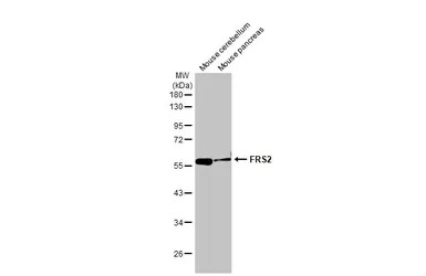 Anti-FRS2 antibody [HL1774] - BSA and Azide free (ab308575) | Abcam