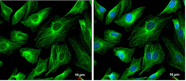 Anti-FSD1 antibody (ab229666) | Abcam