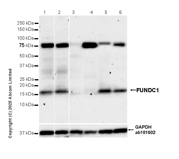 Anti-FUNDC1 antibody [EPR28792-292] (ab323501) | Abcam