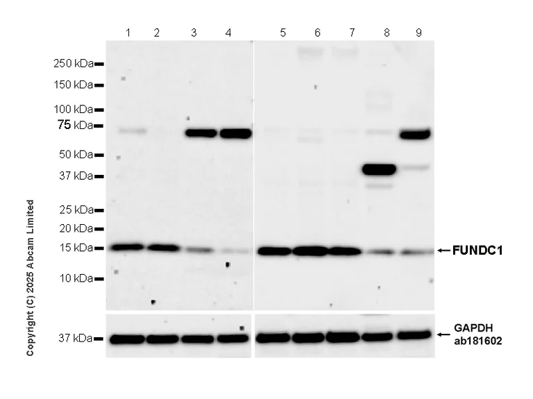 Anti-FUNDC1 antibody [EPR28792-292] (ab323501) | Abcam