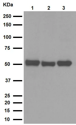 Anti-Fyn antibody [EPR5500] (ab125016) | Abcam