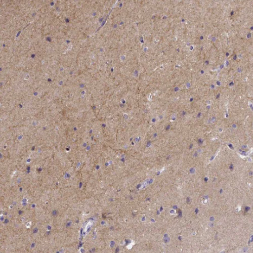 Anti-GABA A Receptor alpha 3/GABRA3 antibody (ab224214) | Abcam