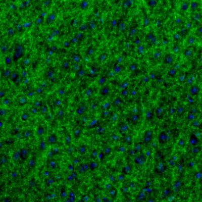 Anti-GABA A Receptor alpha 3/GABRA3 antibody (ab224214) | Abcam