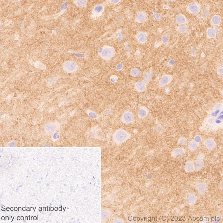 Anti-GABA A Receptor beta 2 antibody [EPR28366-42] (ab309540) | Abcam
