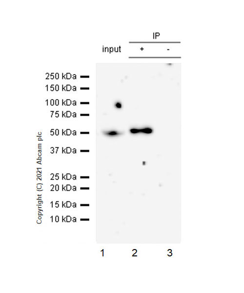 Anti-GABA A Receptor gamma 2/GABRG2 antibody [EPR25325-5] (ab288564 ...